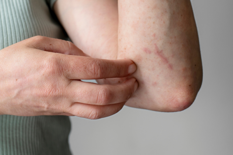 Tanda-Tanda Luka Infeksi – Kenali Sebelum Makin Parah!